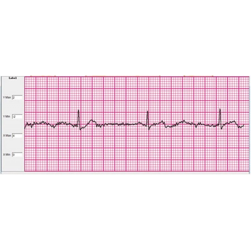 Electronics Wearable Heart Signal ECG Sensor Module with Bluetooth ...